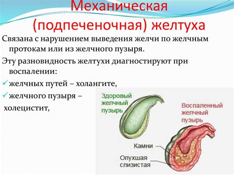 Механическая желтуха Online Presentation