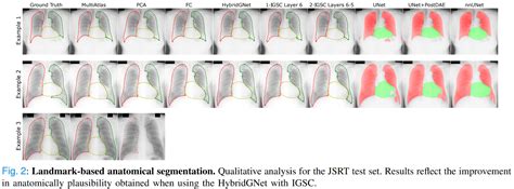 unveil the secrets of anatomical segmentation with hybridgnet an ai