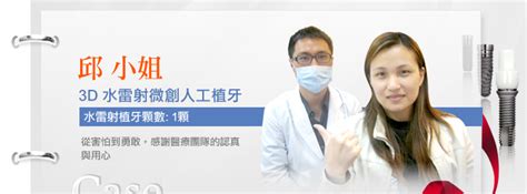 台北桃園植牙 3D水雷射微創人工植牙 尊榮牙醫