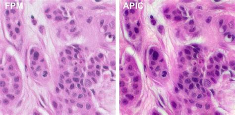 Computational Microscopy Method Removes Distortions Bioscan Sep Oct