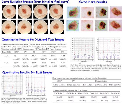 Skin Lesion Project Intelligent Sensor Grid And Informatics Lab