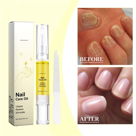 Corn Removers For Feet Extra Strength Stinky Feet 2ml Nail Care