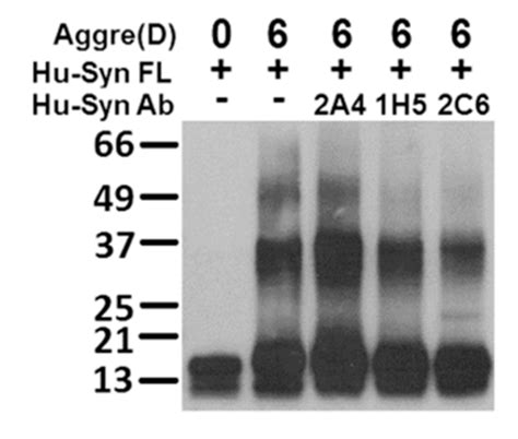 Ijms Free Full Text Identifying The Pathological Domain Of Alpha