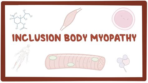 Inclusion Body Myopathy Video Anatomy And Definition Osmosis