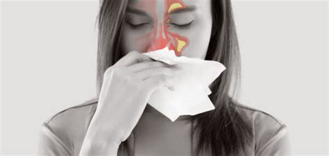 When Fungi Attack Dealing With Fungal Sinusitis Happiest Health