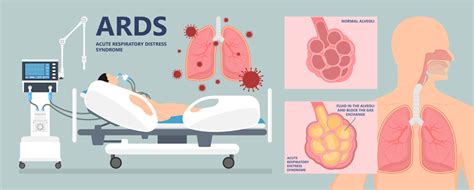 Laboratory Lungs The Implications Of Lung Organoids For Health And