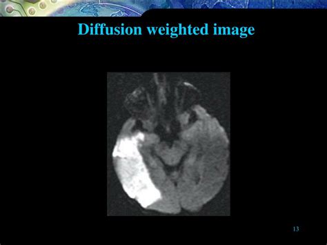 Ppt Diffusion And Perfusion Mri Imaging Powerpoint Presentation Id 448079