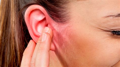 ¿por Qué Las Orejas Se Ponen Rojas Y Se Calientan Misterio Resuelto