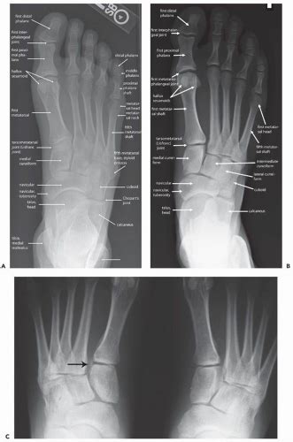 Foot Xray Anatomy