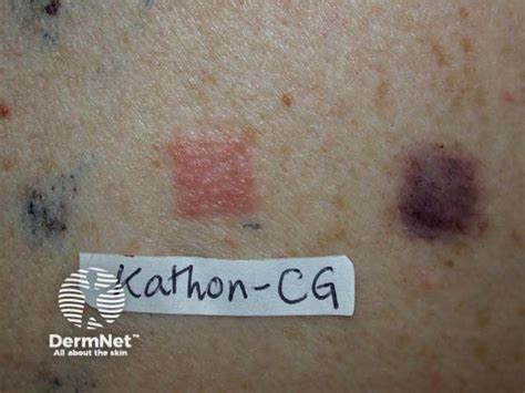 Patch Test Images