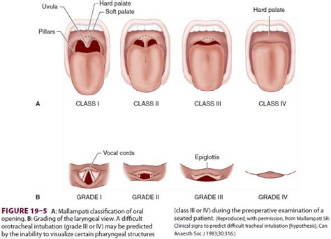 Airway Assessment