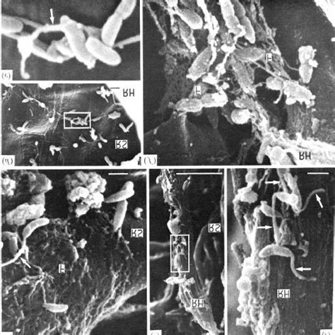 Scanning Electron Micrographs Sems Of Tomato Root Colonization By A