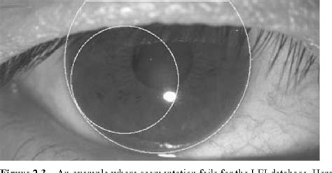 Figure 1 1 From Recognition Of Human Iris Patterns For Biometric