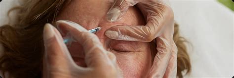 Brow Lift Cosmetic Elegance