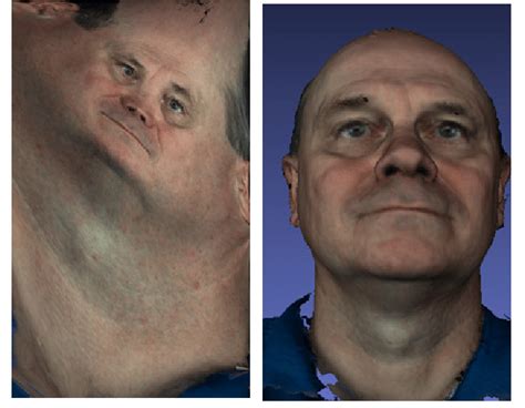 Face Skin Texture Map