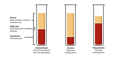 The 9 Best Ways To Increase Hematocrit Levels 2025