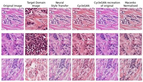 Assessing Domain Adaptation Techniques For Mitosis Detection In Multi Scanner Breast Cancer
