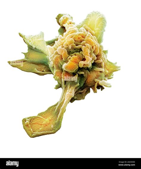 Activated Granulocyte Coloured Scanning Electron Micrograph Sem Of
