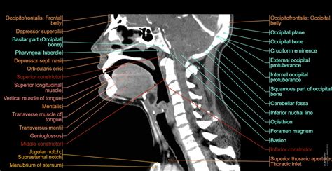 Sagittal Ct