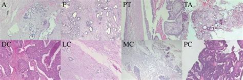 Representative Benign And Malignant Images At 40× Magnification