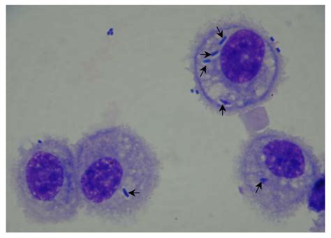 Microscopic View Of Mouse Alveolar Macrophages With K Pneumonia
