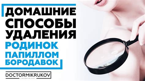 Домашние способы удаления родинок, папиллом, бородавок # ...