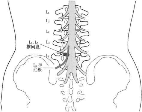 一、直腿抬高试验 外科学 医学