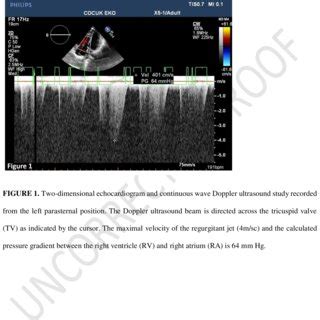 Relationship Between Right Ventricle Systolic Pressure RVSP And RV Fi Download Scientific