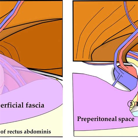 Operation Approach A Tep Field B Tapp Part From Tep Field Download Scientific Diagram