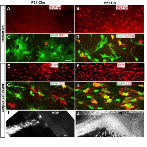 Deficient Mbp Expression In The Brain Of Gpr17 Transgenic Micea Life