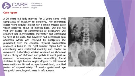 PPT Lithopedion Diagnosed During Infertility Workup A Case Report