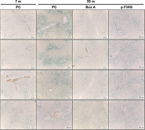 Erratum To “the Roles Of Hmgb1‐produced Dna Gaps In Dna Protection And Aging Biomarker Reversal