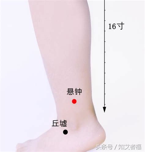 艾灸治療靜脈曲張 每日頭條
