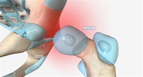 Premium Photo Hip Dysplasia Occurs When The Hip Socket Is Too Shallow
