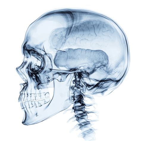 x ray skull anatomy free sinister skull x ray image download at