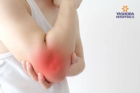 Cubital Tunnel Syndrome What Is Cubital Tunnel Syndrome Its Causes