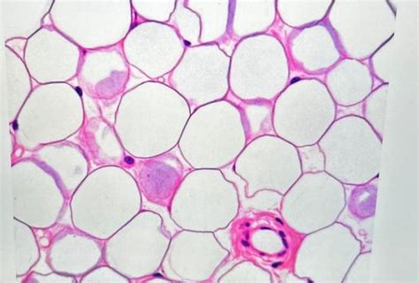 Solved 9 Label The Following Monocot Or Dicot 10
