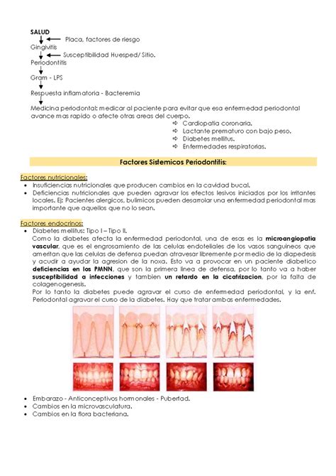 Sindesmotomía y exodoncia: técnicas y procedimientos en cirugía bucal - Studocu