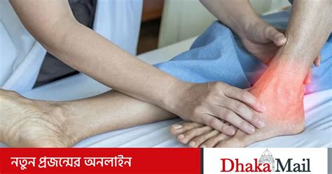 ইউরিক অ্যাসিডের মাত্রা বেশি হলে কী করবেন
