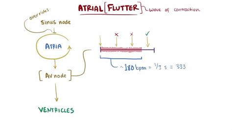 Atrial Flutter Cardiovascular Disorders Msd Manual Professional Edition