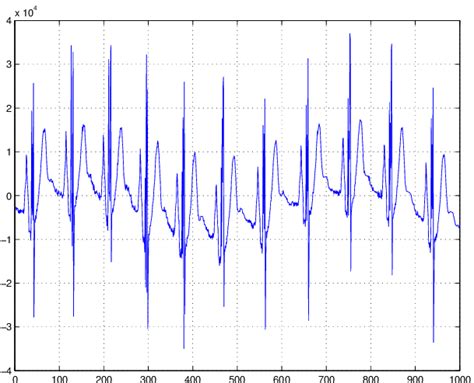 Effect Of The Baseline Wander Phenomenon Over The Proposed Curve Download Scientific Diagram