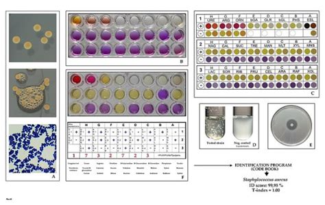 What Is The Difference Between Serotype And Biotype Pediaacom