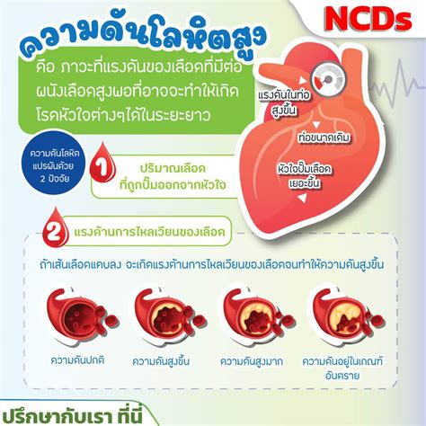 ความดันโลหิตสูง Mixed Oil ฟื้นฟูโรคเสื่อม สาขา 7 Facebook