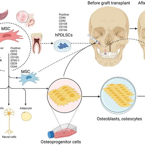 Root Resorption Classification Score According To Malmgren 17 Degree