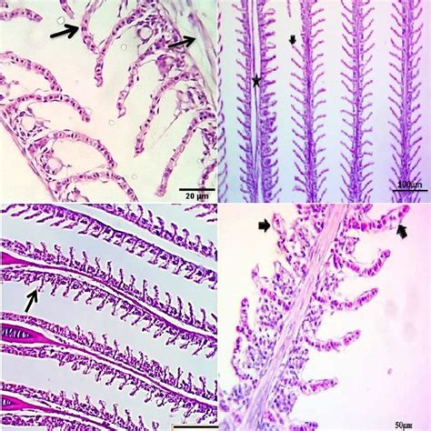 Photomicrograph From Gills Control Group A Showing Normal Primary And