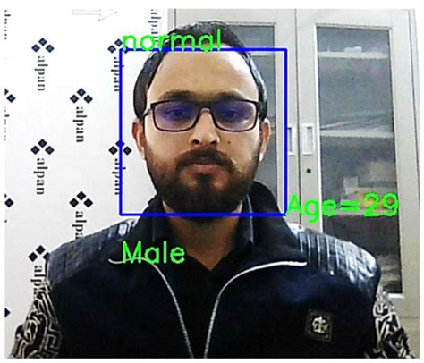 Biomedinformatics Free Full Text Automatic Facial Palsy Age And