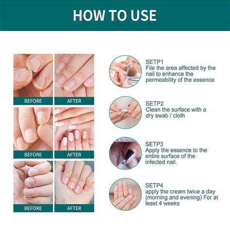 3pcs Nail Fungal Brush Against Nail Fungal Infection 2 In1 Treat