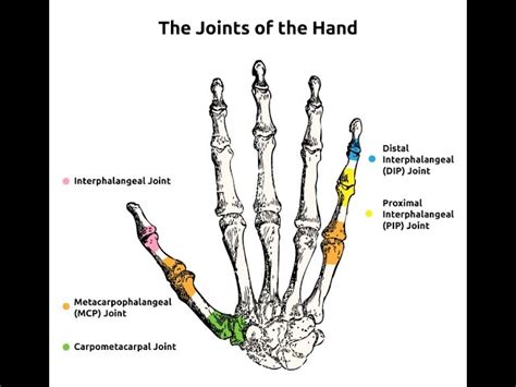 Interphalangeal Joint Interphalangeal Joint Dislocation Radiology