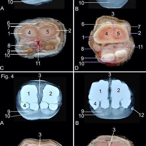 Ct Scans And Cross Sections At The Base Of The Left Large Metacarpal