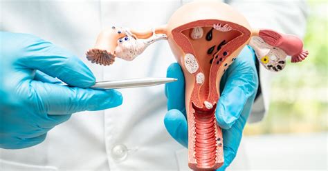 Cervical Cancer Treatment Cost